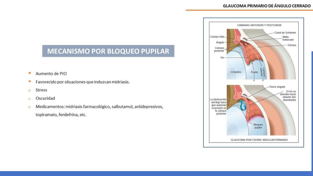 ACTUALIZACIÓN DE GLAUCOMA EN ÁNGULO CERRADO - Oftalmologo Quito - Dr ...