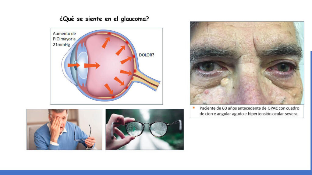 ACTUALIZACIÓN DE GLAUCOMA EN ÁNGULO CERRADO - Oftalmologo Quito - Dr ...