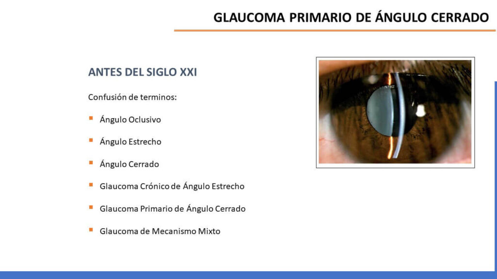 ACTUALIZACIÓN DE GLAUCOMA EN ÁNGULO CERRADO - Oftalmologo Quito - Dr ...