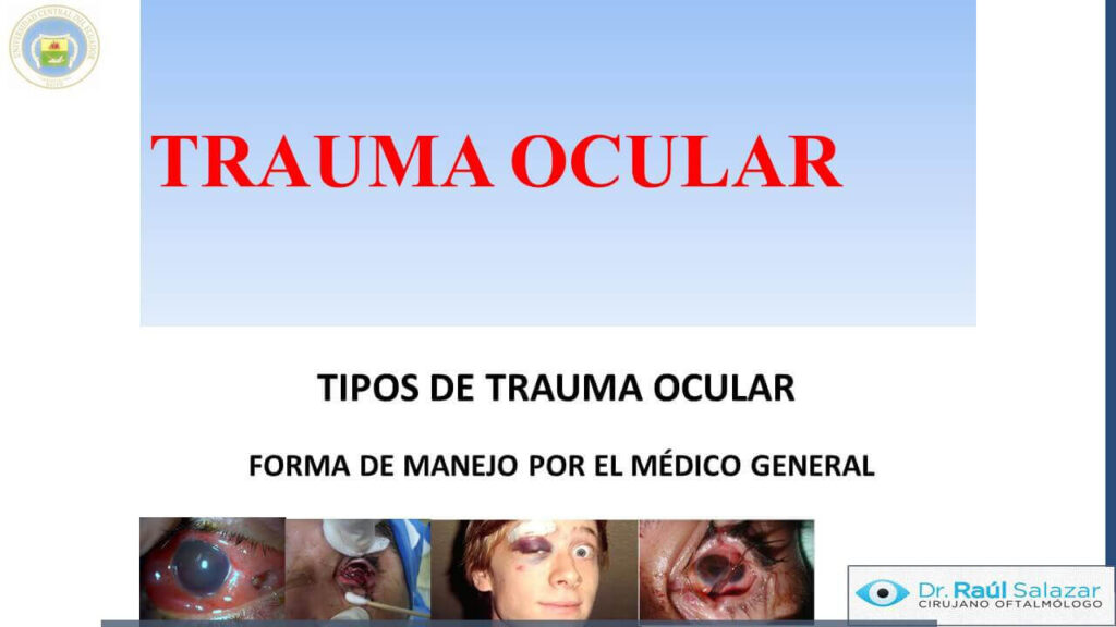 TRAUMA OCULAR - Oftalmologo Quito - Dr. Raúl Salazar Zambrano